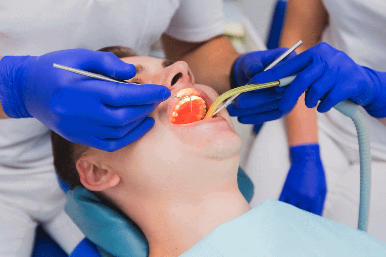 Fluoride Dental Treatment - Kitcha Dental Clinic Chiang Mai