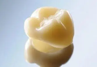 Dental Crown - Kitcha Dental Clinic Chiang Mai